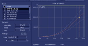 Hadlock | Fetalmed Medicina Fetal e Diagnósticos por Imagem Curitiba