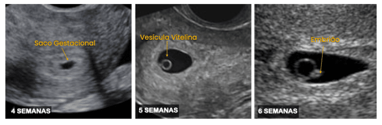 Descobrindo a Magia: Quando Realizar o Primeiro Ultrassom