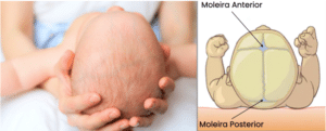 A Moleira do Bebê: Um Guia Completo para os Pais - Fetalmed
